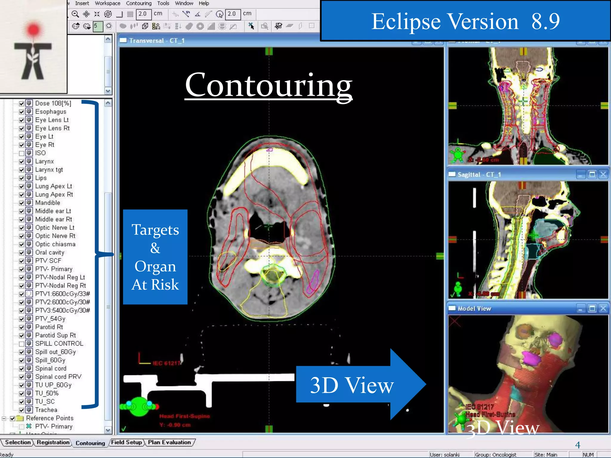 Pen tablet vs mouse for Contouring OAR and targets | PPTX
