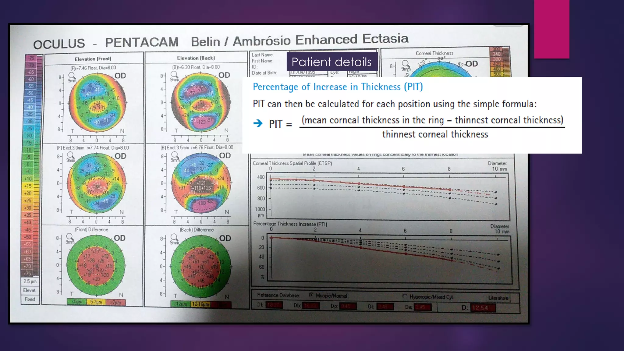 Pentacam | PDF