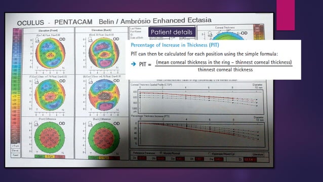 Pentacam | PDF | Eye and Vision Conditions | Diseases and Conditions