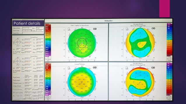 Pentacam | PDF | Eye and Vision Conditions | Diseases and Conditions