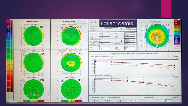 Pentacam | PDF | Eye and Vision Conditions | Diseases and Conditions