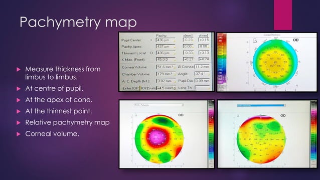 Pentacam | PDF | Eye and Vision Conditions | Diseases and Conditions
