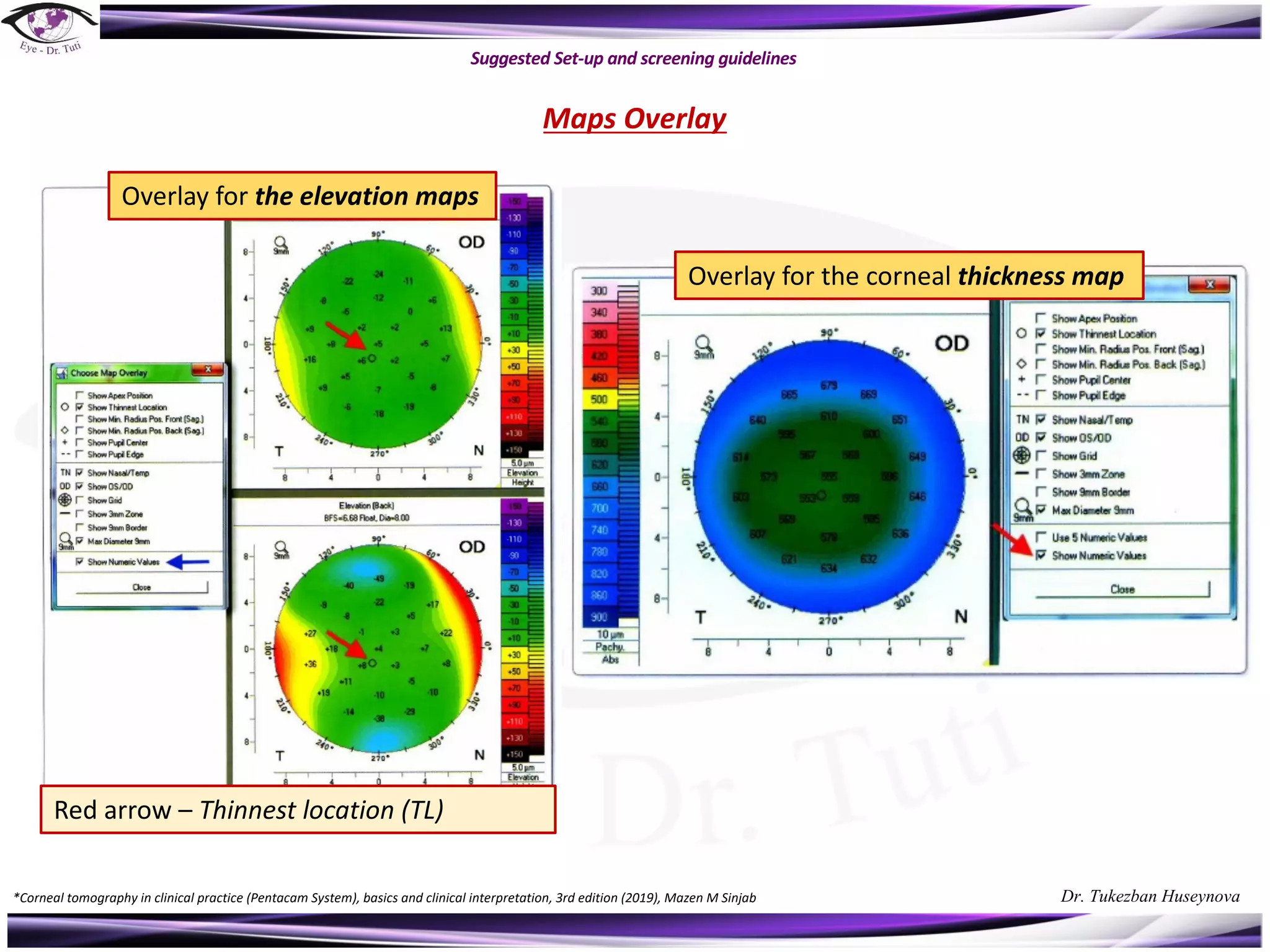 "Pentacam" from the beginning | PDF