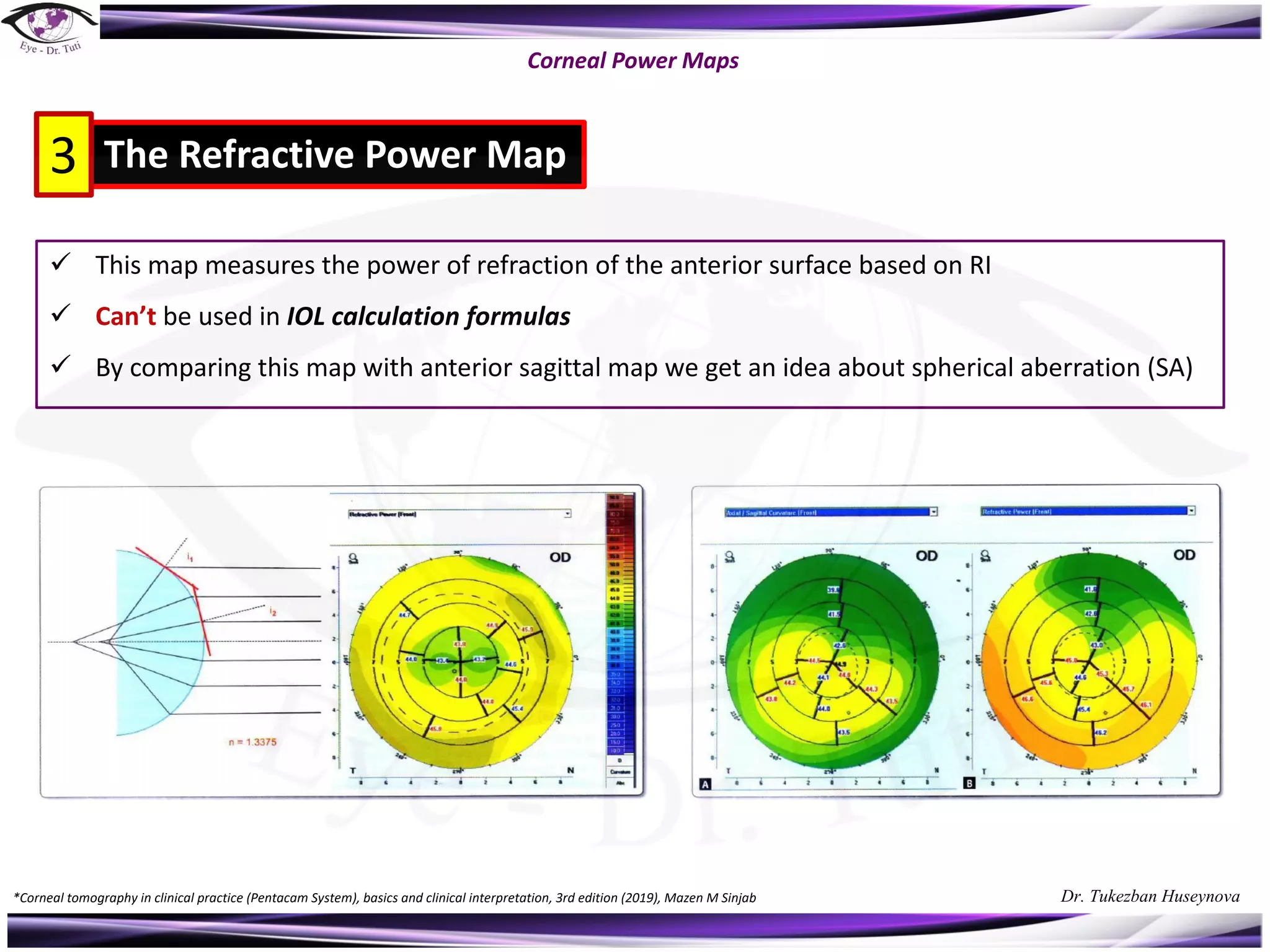 "Pentacam" from the beginning | PDF