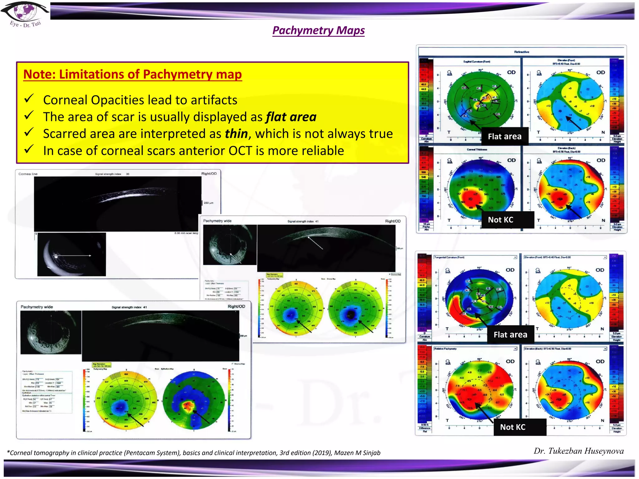 "Pentacam" from the beginning | PDF
