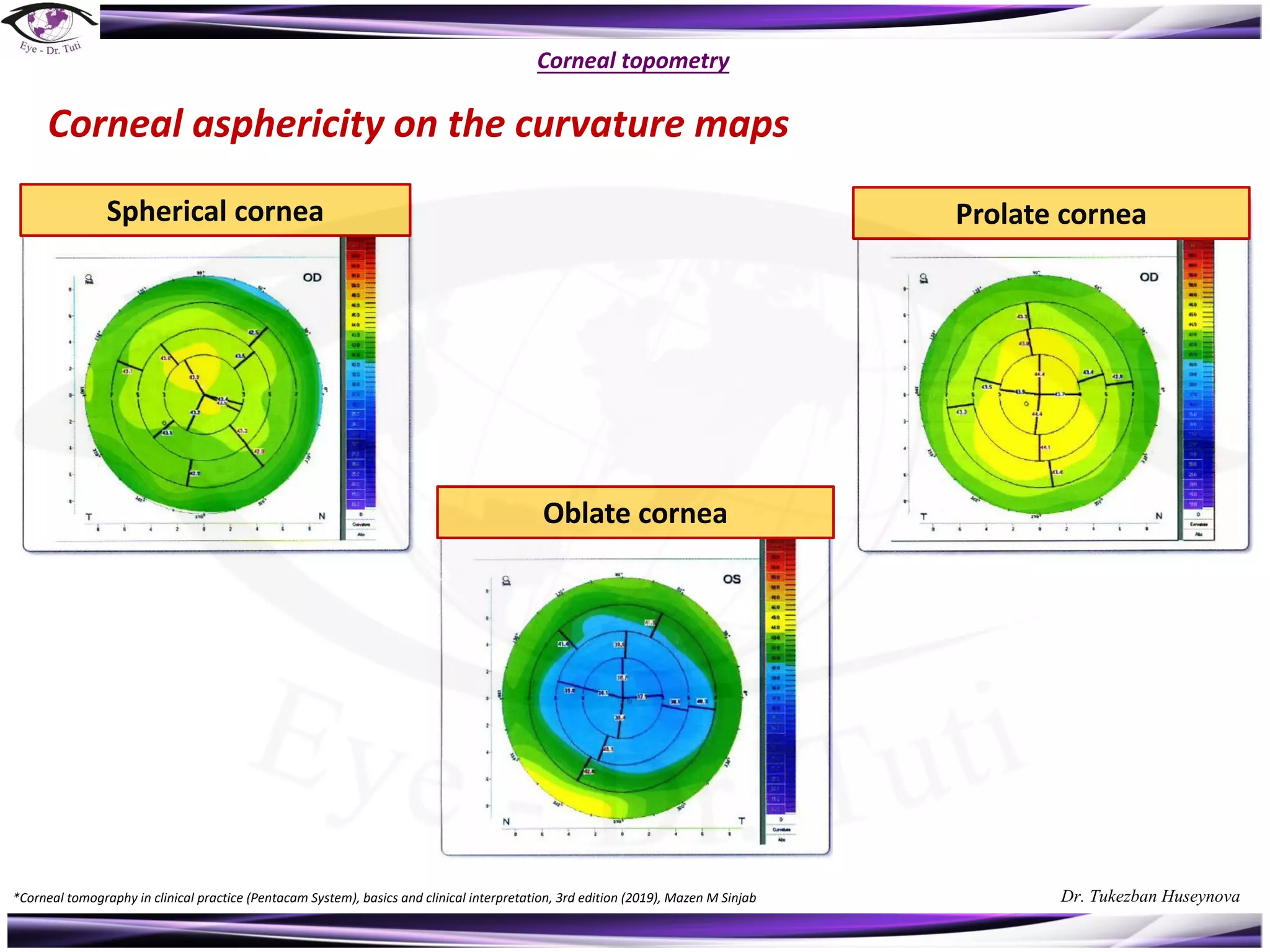 "Pentacam" from the beginning | PDF