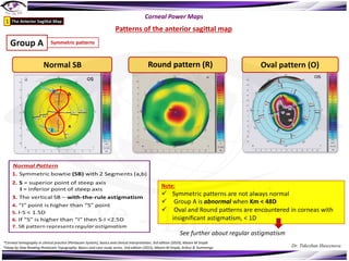 "Pentacam" from the beginning | PDF