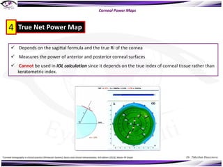 "Pentacam" from the beginning | PDF