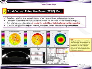 "Pentacam" from the beginning | PDF