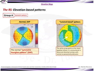 "Pentacam" from the beginning | PDF