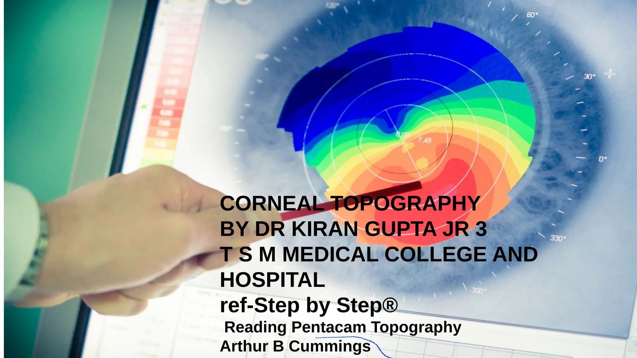 PENTACAM.pptx ppt.pptx corneal topography | PPTX
