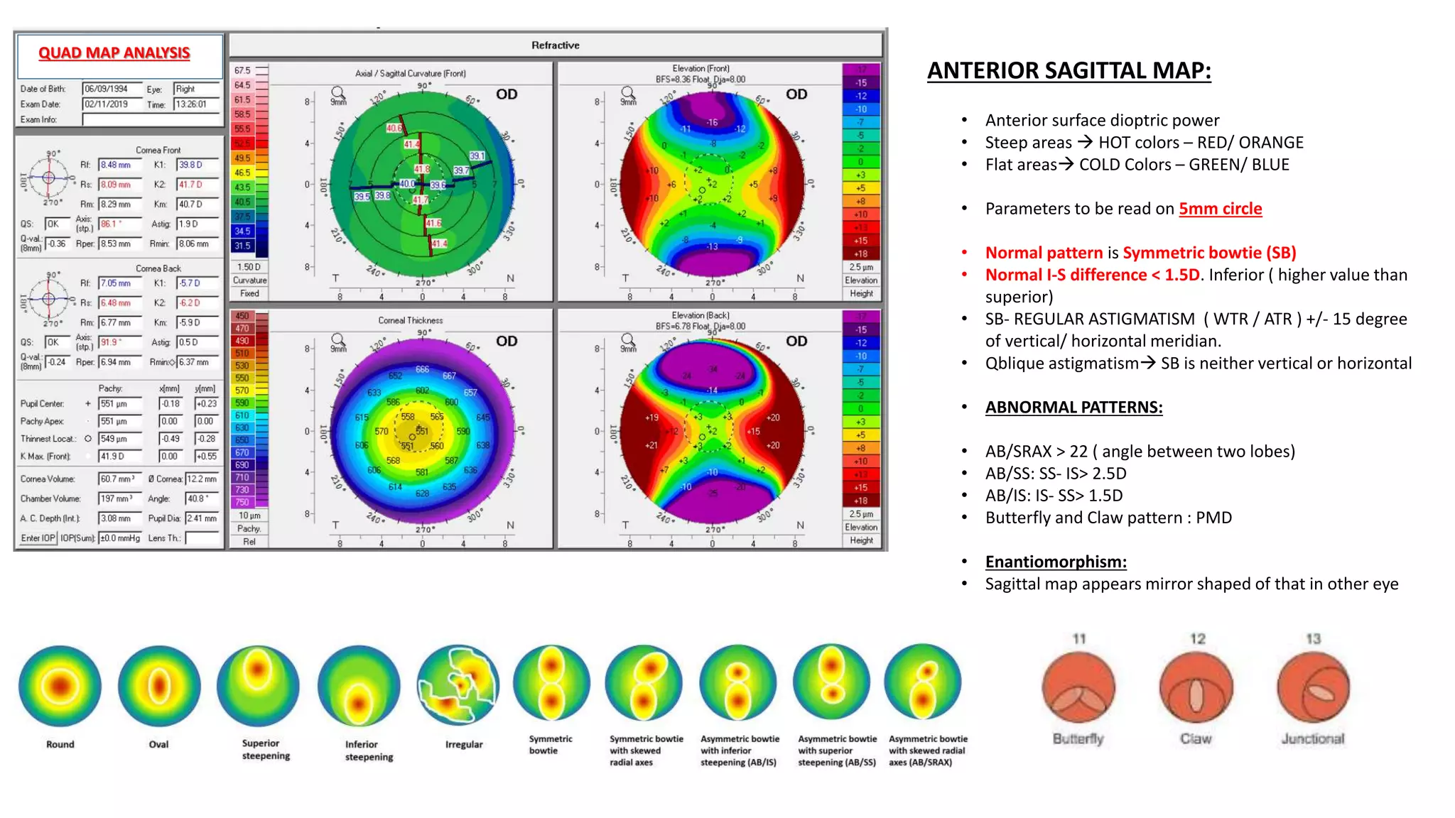 Pentacam analysis | PPTX