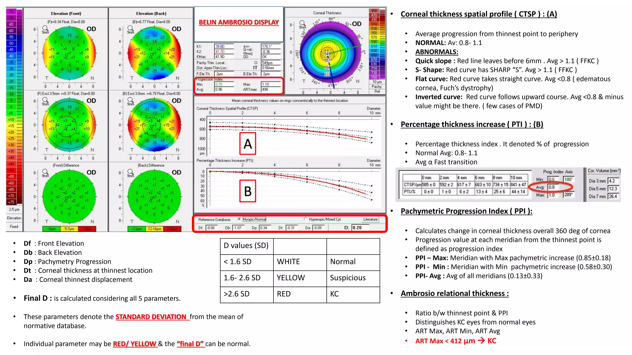 Pentacam analysis | PPTX
