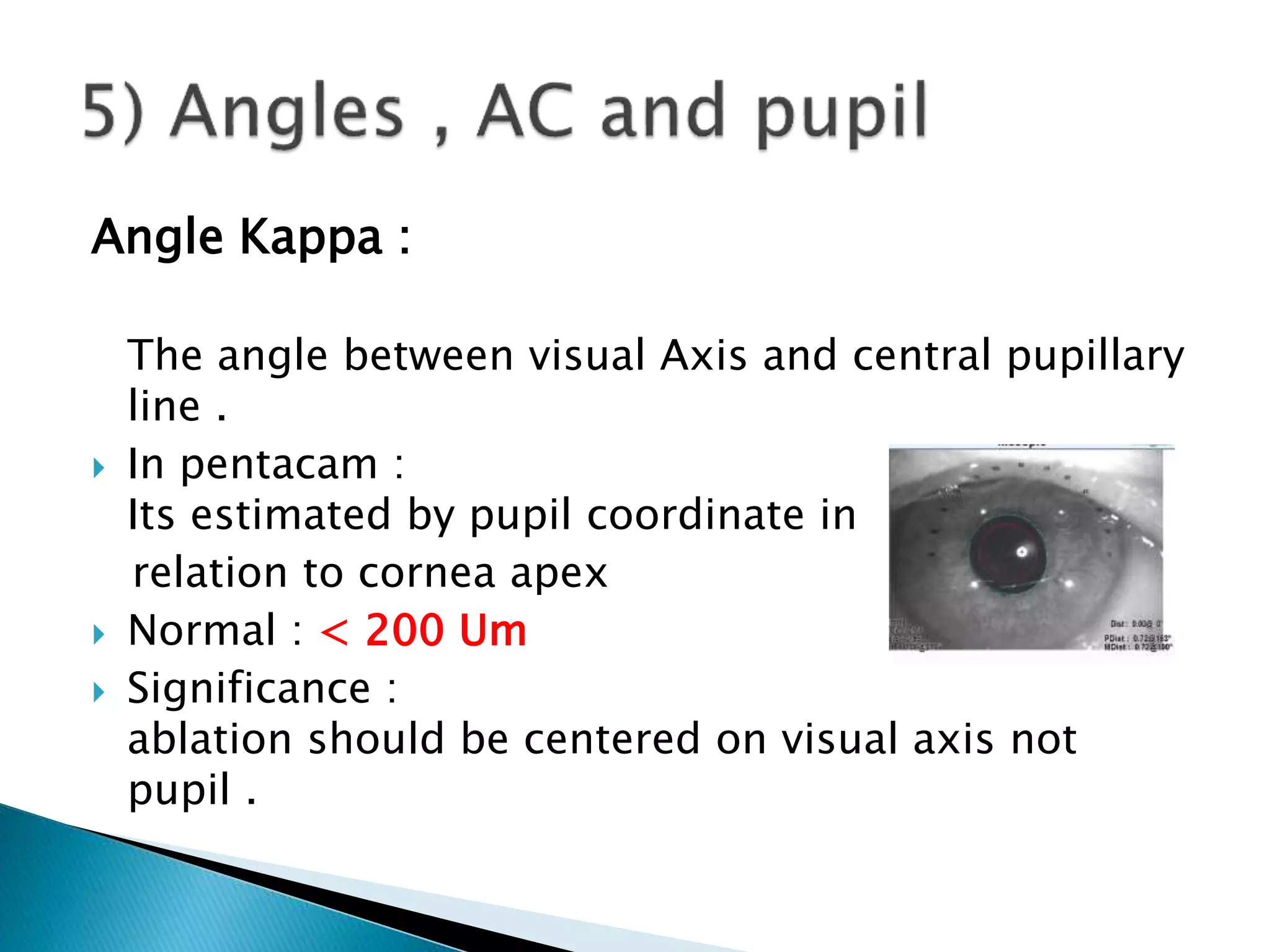 Pentacam and topography | PPTX