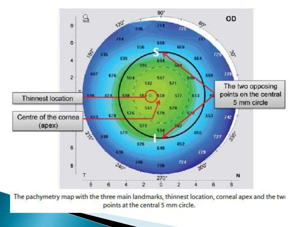 Pentacam and topography