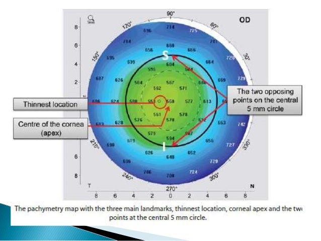 Pentacam and topography