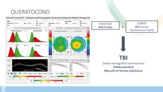 PENTACAM. Tomografía y topografía corneal. Olivia Rodríguez Quet | PPTX