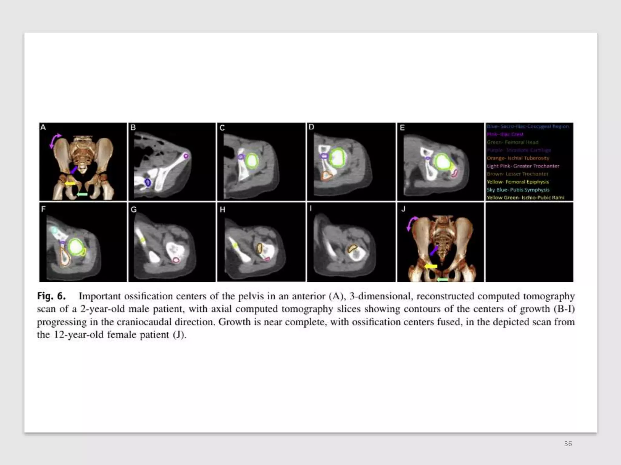 PENTEC GUIDELINES FOR PAEDIATRIC RADIOTHERAPY | PPTX