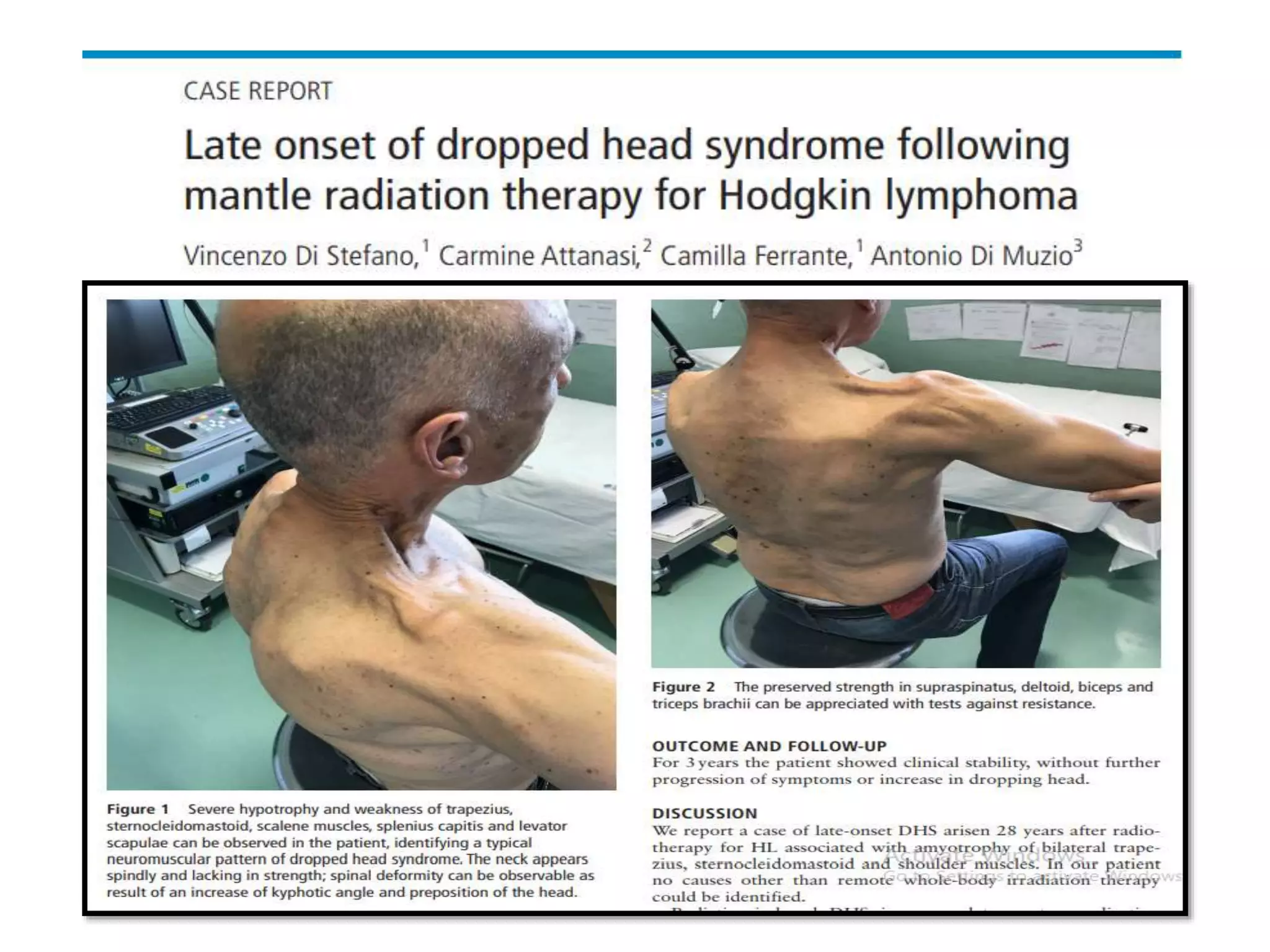 PENTEC GUIDELINES FOR PAEDIATRIC RADIOTHERAPY | PPTX