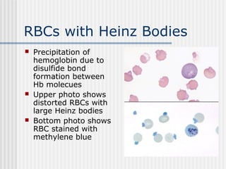 Pentose phosphate pathway | PPT