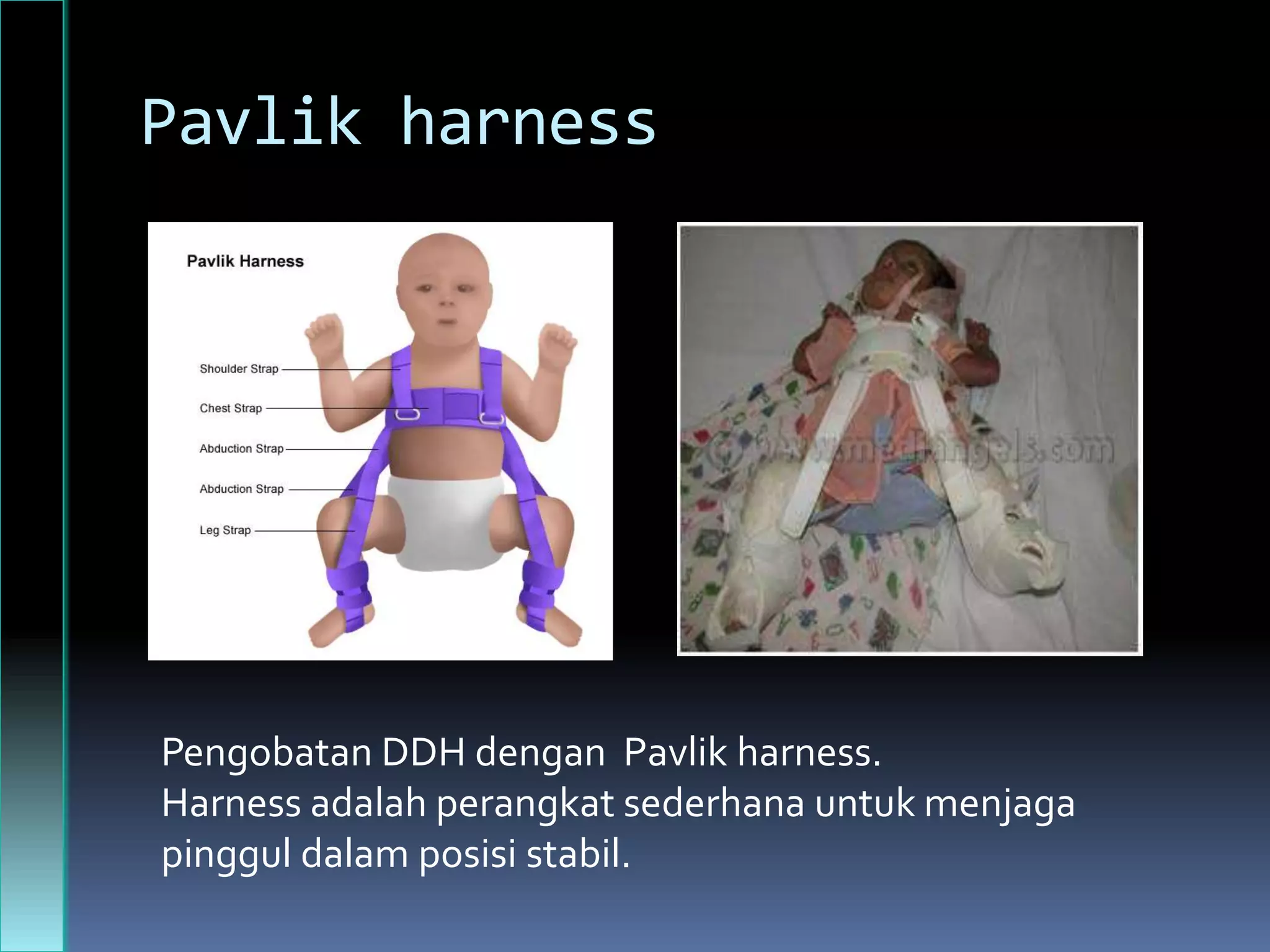 Penunjang-Diagnostik-Fisioterapi-pptx | PPTX