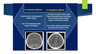 Type of Brain Edema adn Pathophysiology.pptx