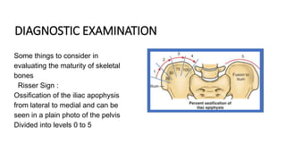 PENUNJANG PUNGGUNG.pptx | Bone and Joint Conditions | Diseases and ...