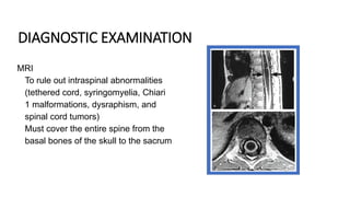 PENUNJANG PUNGGUNG.pptx | Bone and Joint Conditions | Diseases and ...