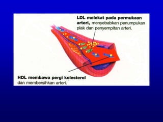 Penyakit jantung-koroner rrrrrr | PPT
