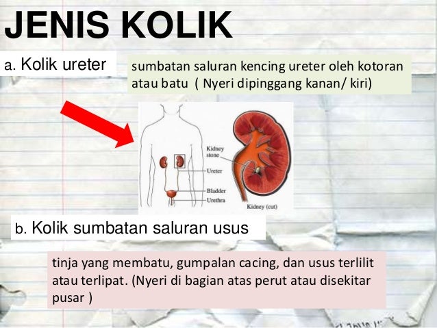 Penyakit Kolik Adalah - Homecare24
