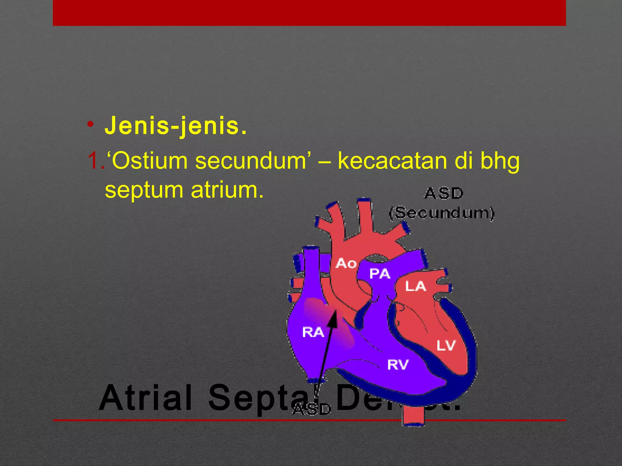 PENYAKIT-PENYAKIT JANTUNG KONGENITAL | PPT