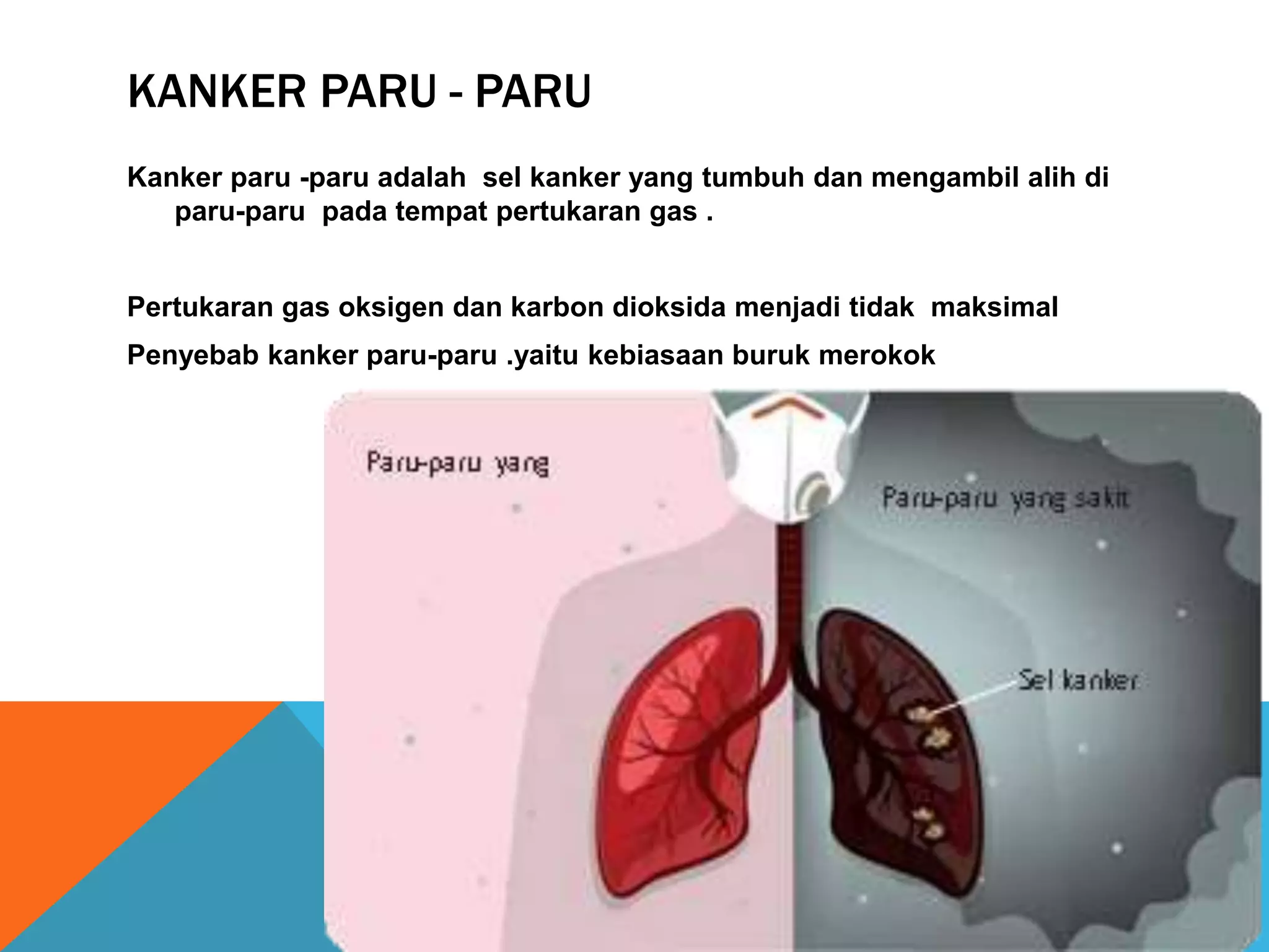 Penyakit - penyakit pada sistem pernapasan oleh rokok.ppt
