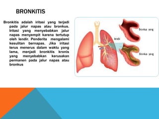 Penyakit - penyakit pada sistem pernapasan oleh rokok.ppt