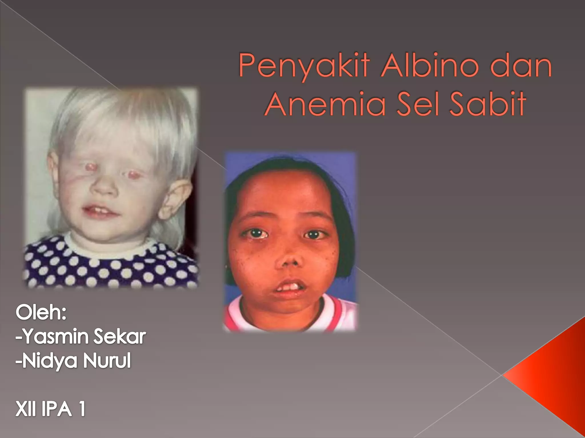 Penyakit albino dan anemia sel sabit | PPTX