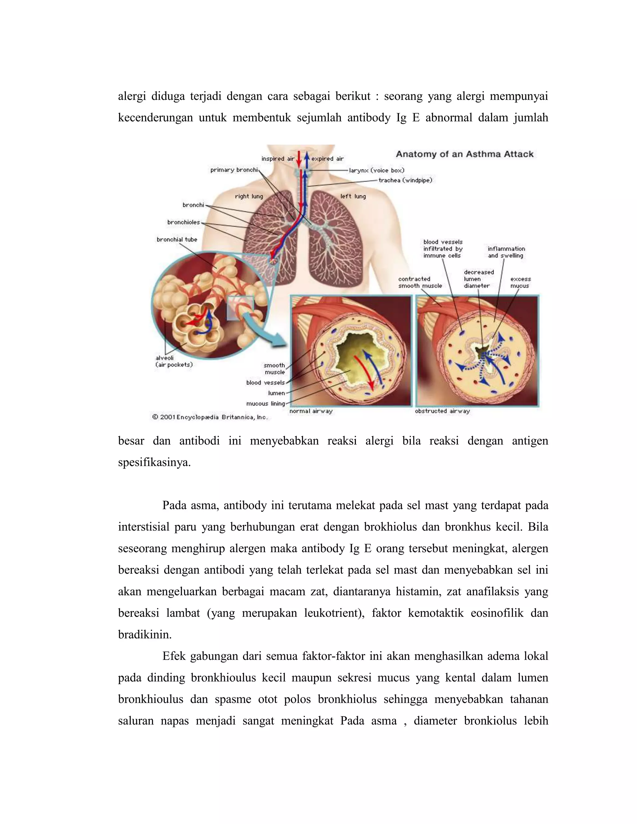Penyakit asma revisi | DOCX