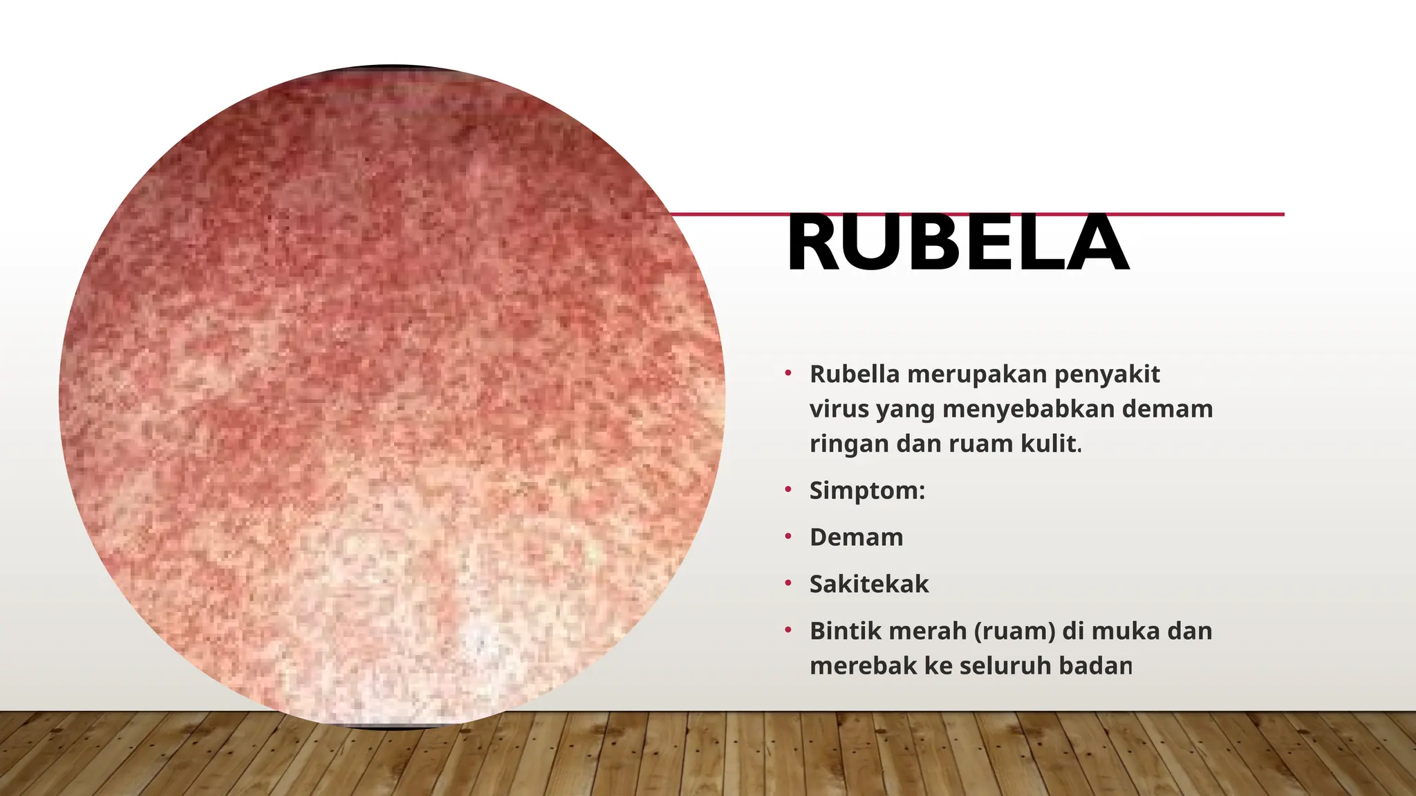 PENYAKIT BERJANGKIT P. JASMANI DAN KESIHATAN | PPTX