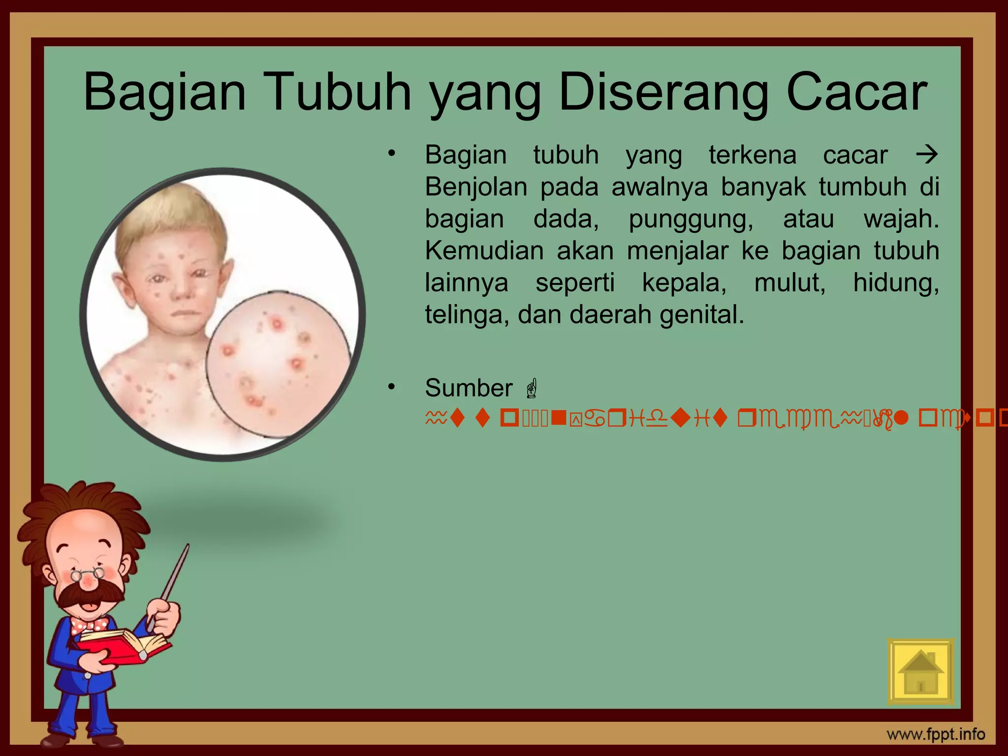 Penyakit Cacar ppt biologi | PPT
