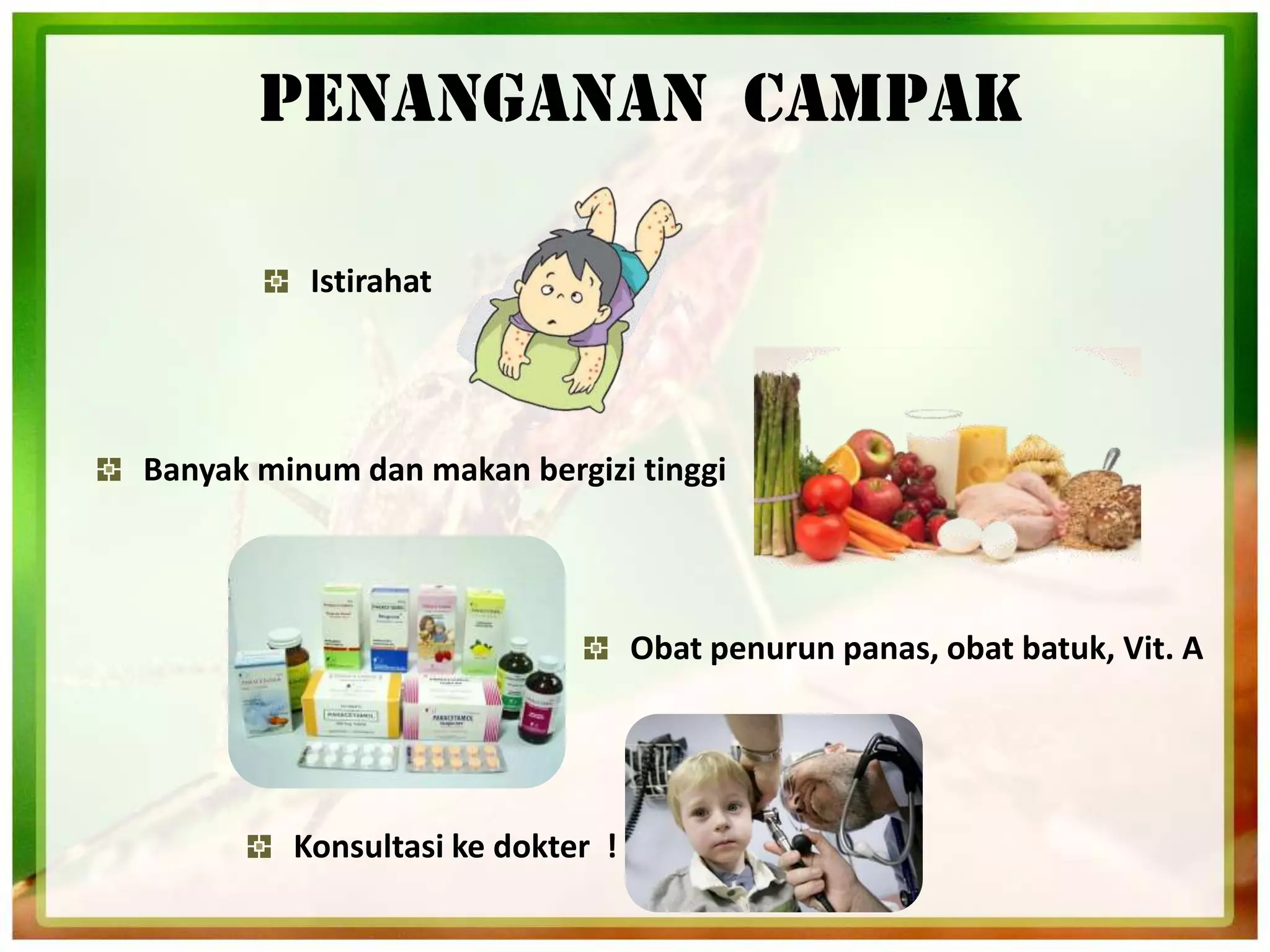 Penyakit campak measles | PPTX