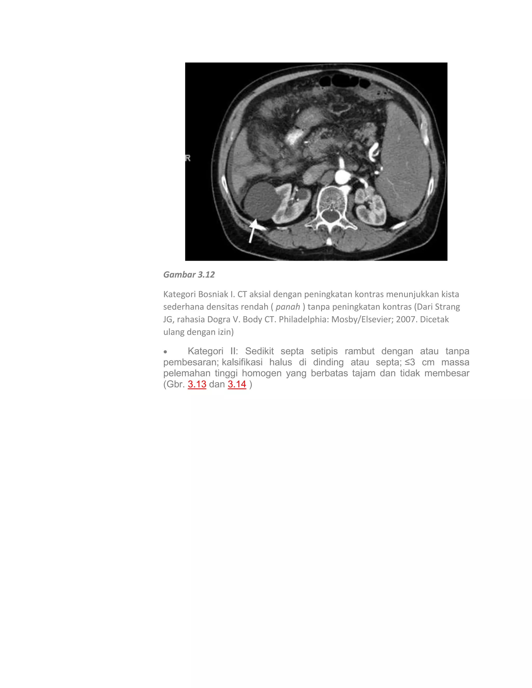 Penyakit ginjal polikistik dominan autosomal.docx