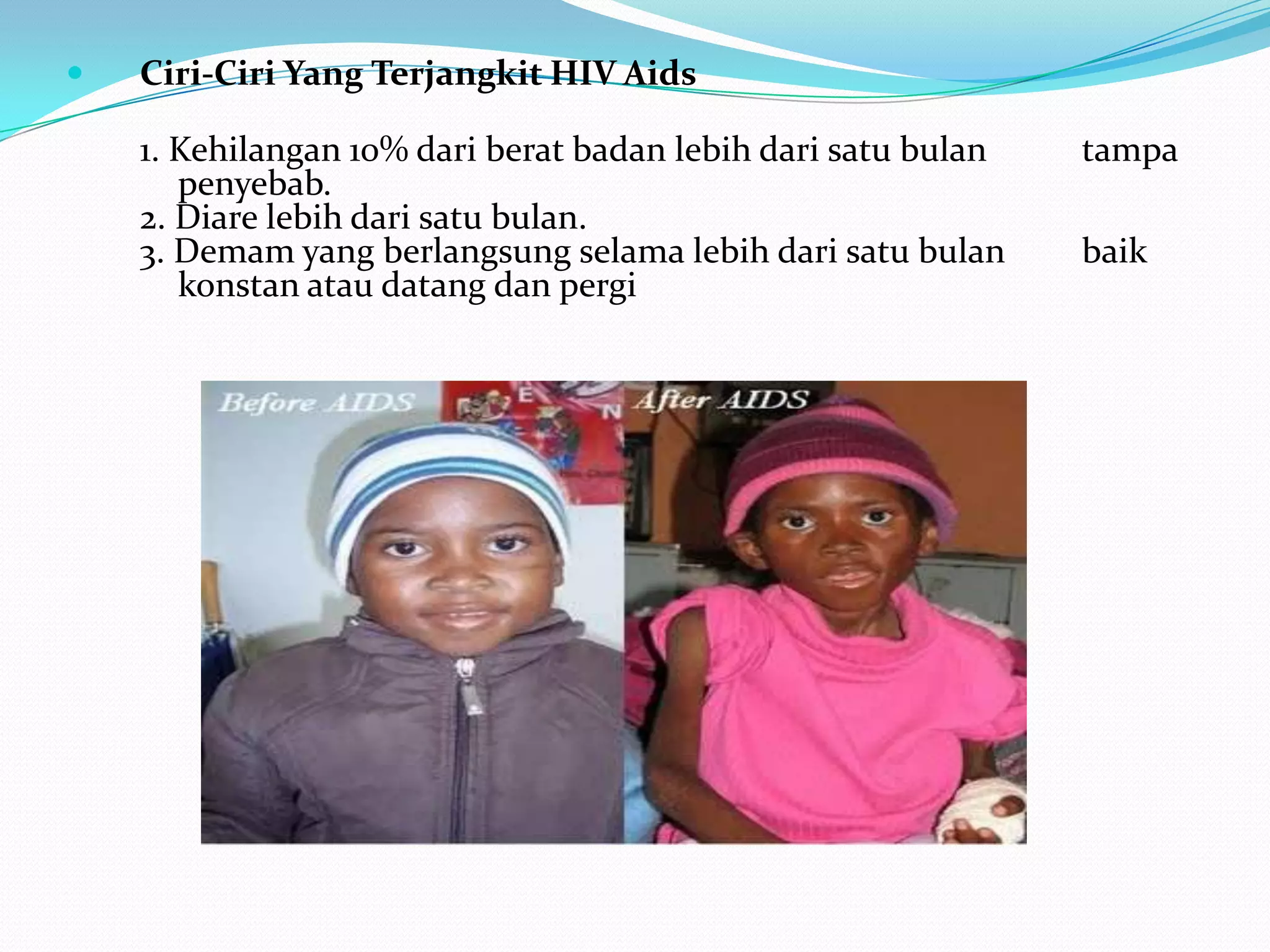 Penyakit hiv aids | PPTX