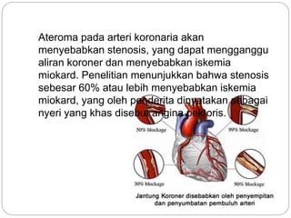 tatalaksana Penyakit_Jantung_Koroner_(PJK).pptx
