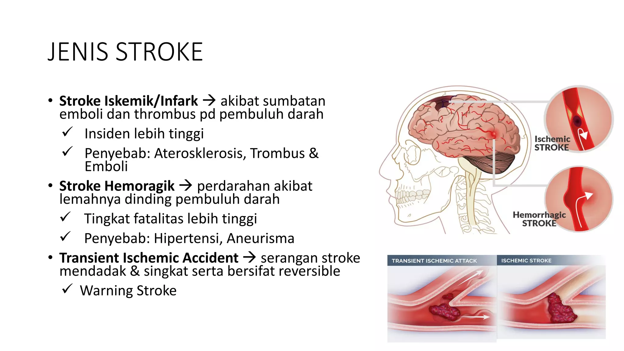 Penyakit Kardiovaskuler.pdf
