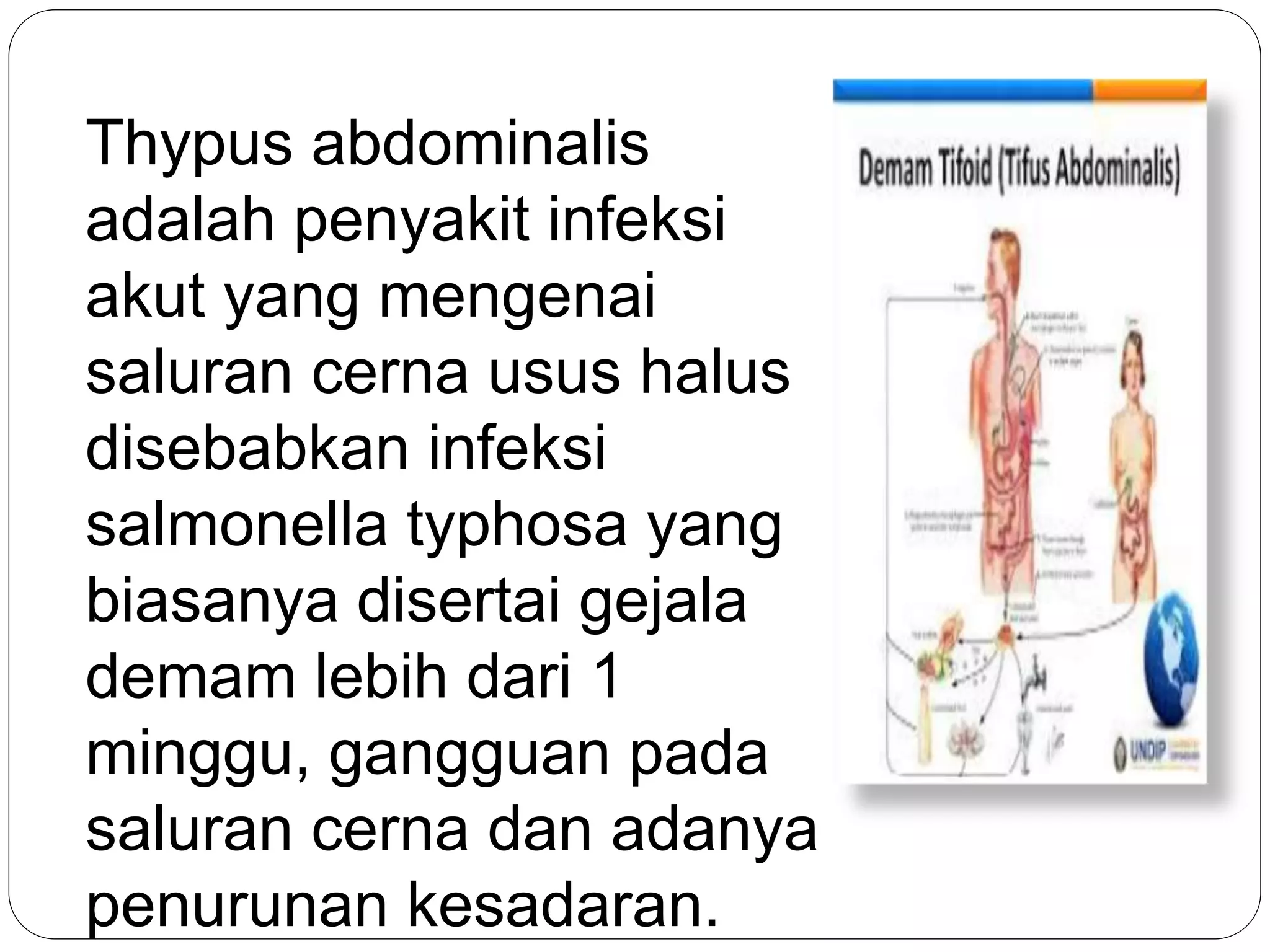 TYPHUS ABDOMINALIS | PPTX