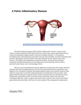 Penyakit Kelamin (Bakteri) | DOC