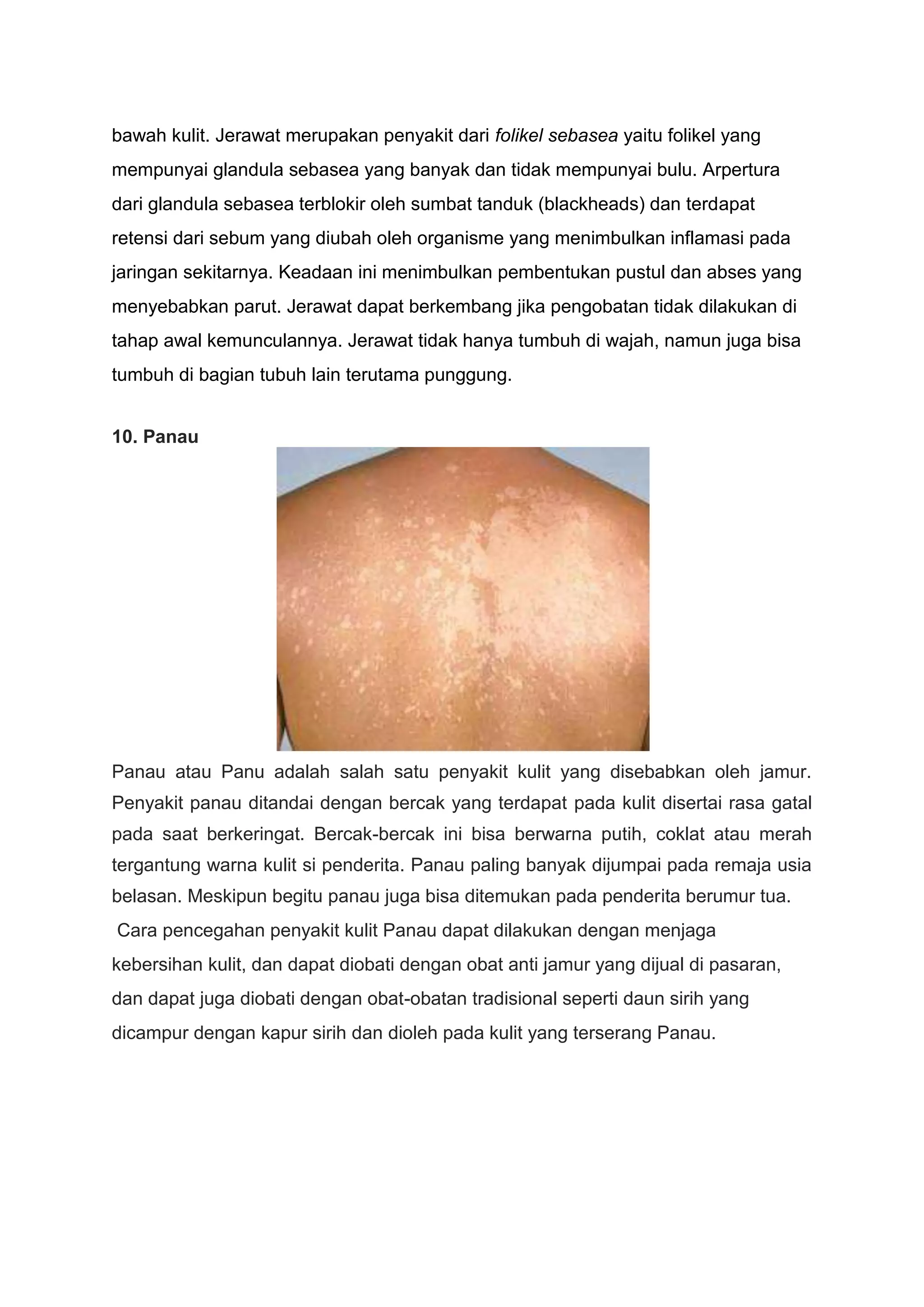 Penyakit kulit | DOCX