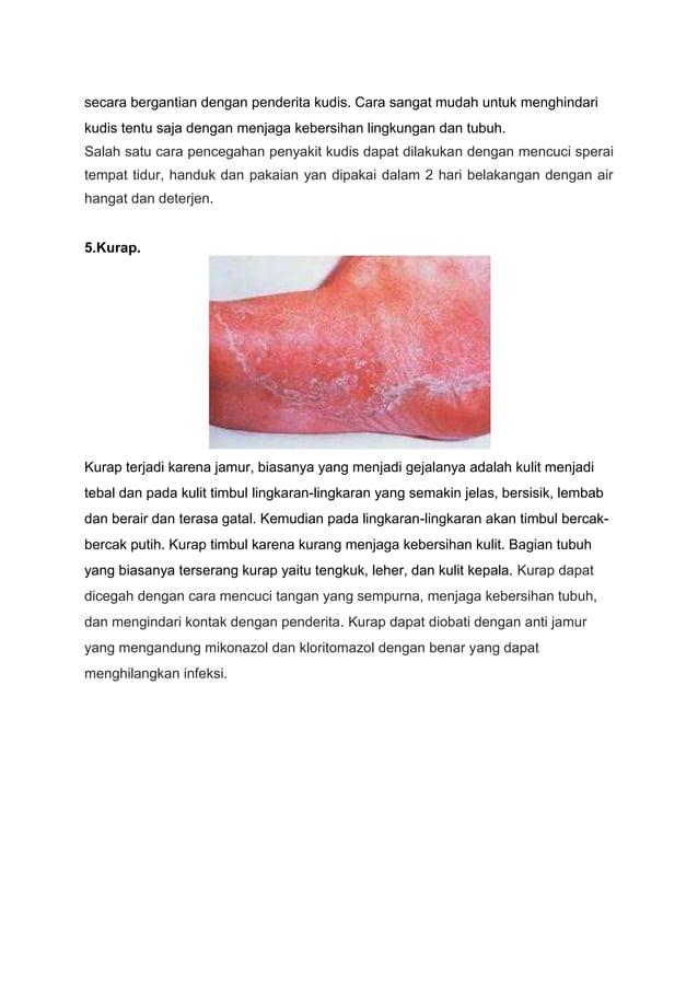 Penyakit kulit | DOCX