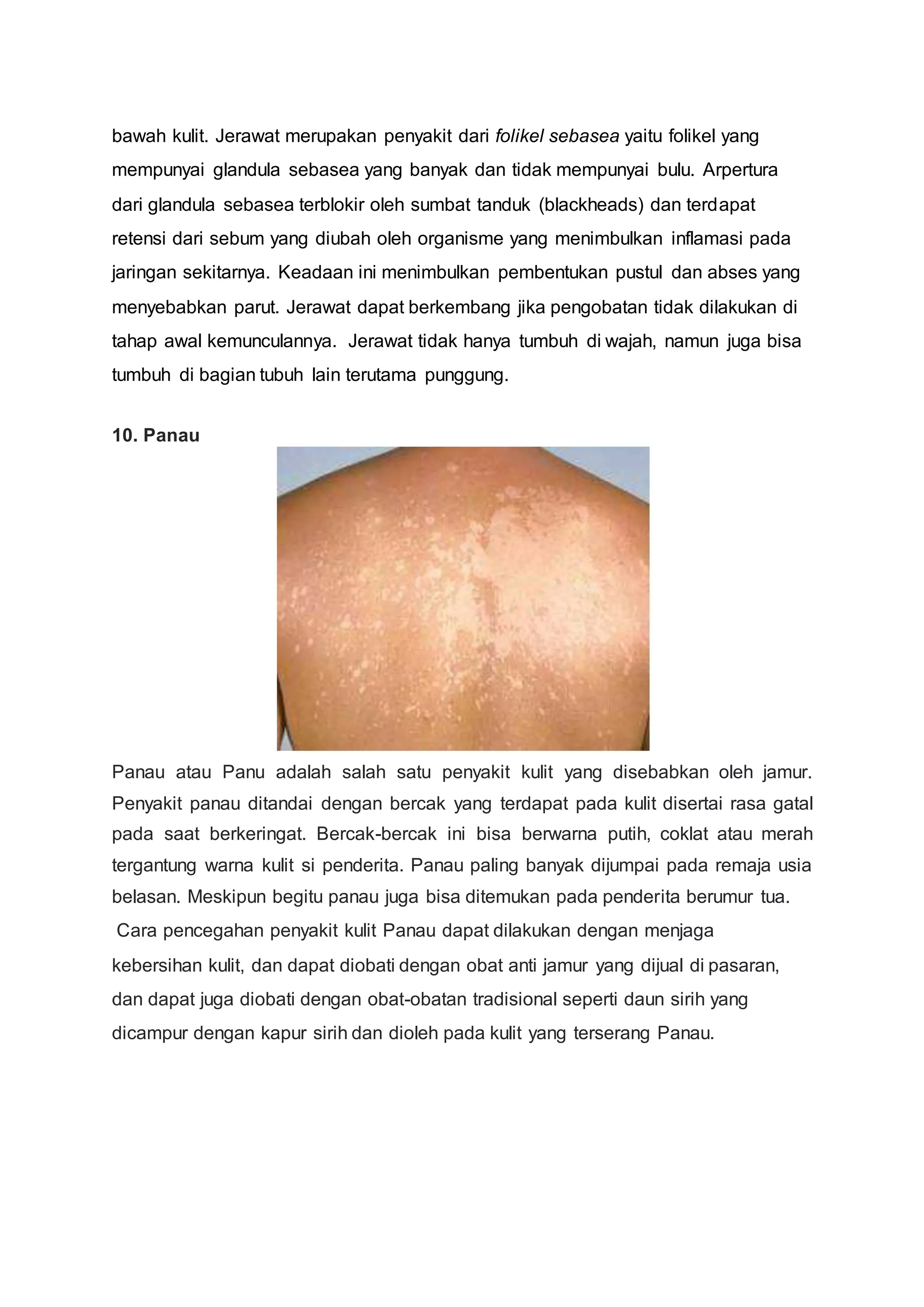 Penyakit kulit | DOTX