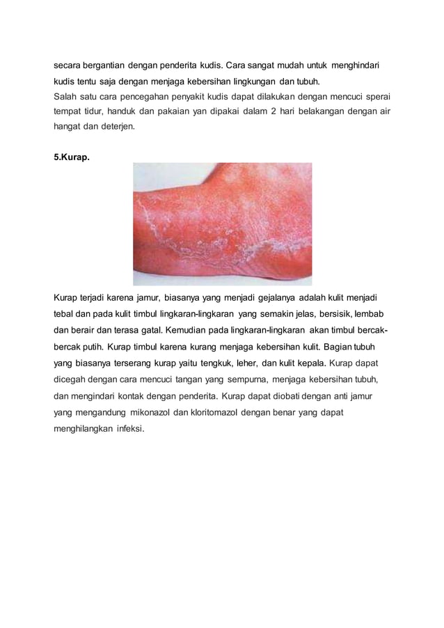 Penyakit kulit | PDF
