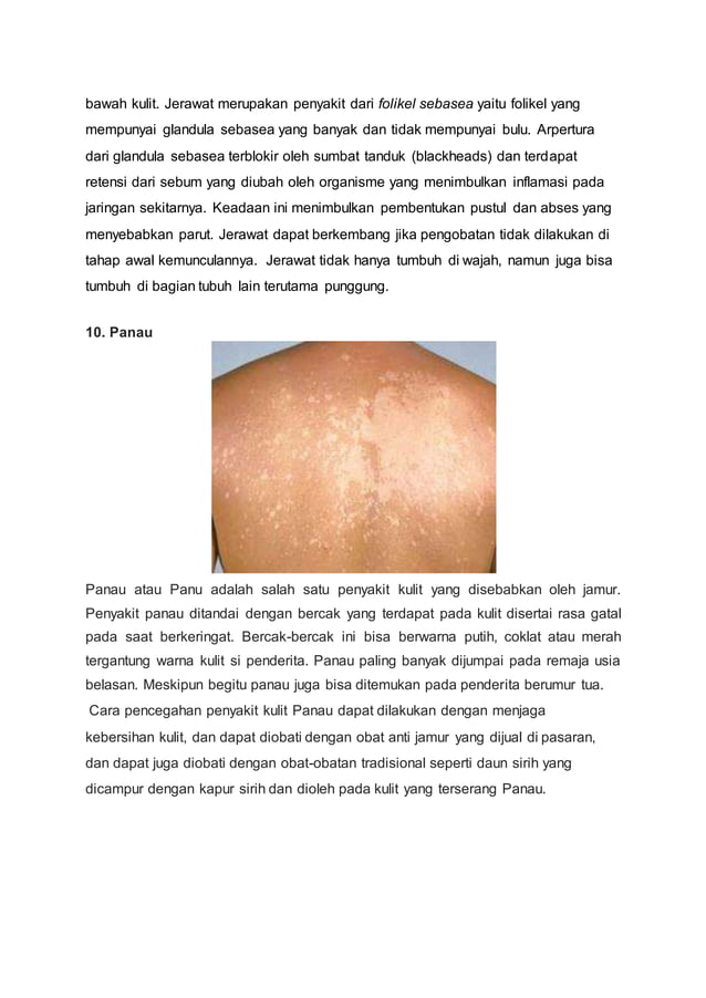 Penyakit kulit | PDF