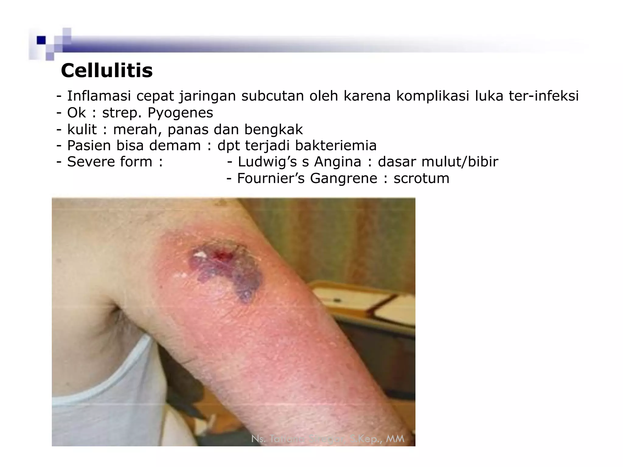 PENYAKIT KULITA AKIBAT BAKTERI.pdf